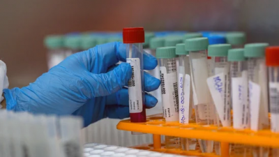 Viral transport Media: A Sample to Answer System with Clinical Relevance